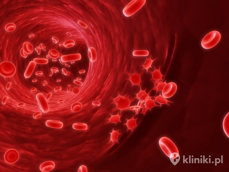 Terapia odmładzająca PRP Angel System | Kliniki.pl