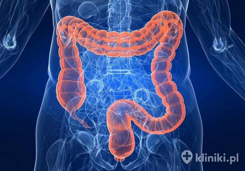 Fortrans i inne preparaty przed kolonoskopią | Kliniki.pl