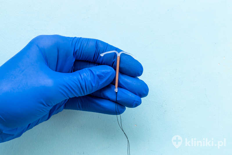 Wkładka Kyleena – nowoczesna antykoncepcja dla kobiet | Kliniki.pl