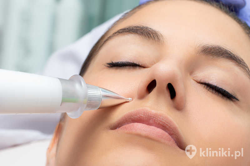 Odmładzanie osoczem bogatopłytkowym Angel PRP System | Kliniki.pl