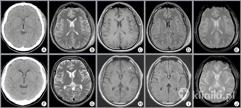 Rezonans magnetyczny głowy | Kliniki.pl