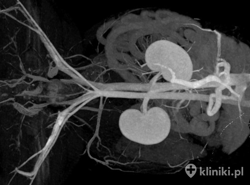 Urografia MR | Kliniki.pl