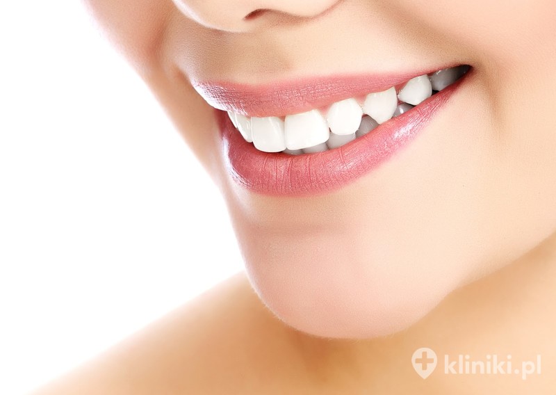 Dieta po wszczepieniu implantów zębowych | Kliniki.pl Dieta po wszczepieniu implantów zębowych | Kliniki.pl