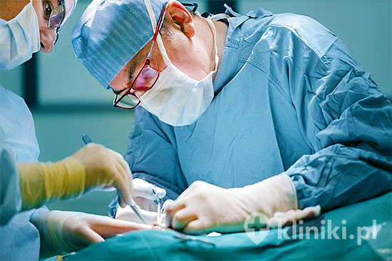 Operacje żylaków odbytu metodą klasyczną | Kliniki.pl